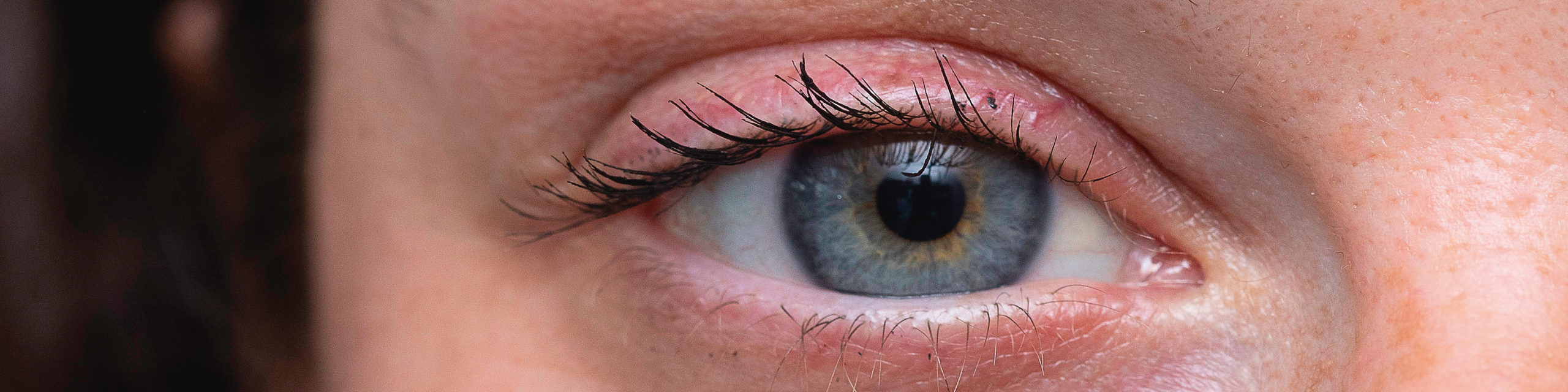 Nyheter avseende diagnostik och behandling vid MG - Neurologi i Sverige